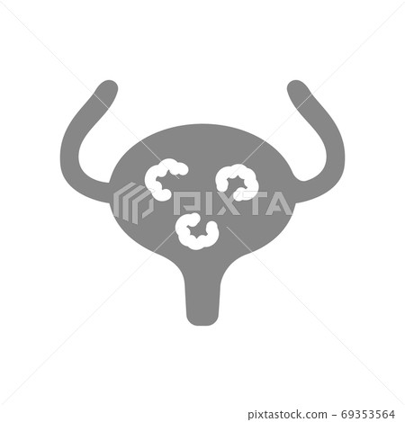 Human urinary bladder with tumors gray icon.... - Stock Illustration ...