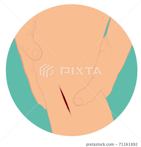 injured leg with bleeding gash with wound on... - Stock Illustration ...