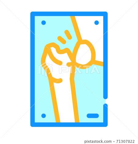 hip fracture x-ray color icon vector illustration-插圖素材 [71307822] - PIXTA圖庫