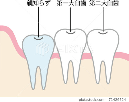 Wisdom tooth illustration - Stock Illustration [71426524] - PIXTA