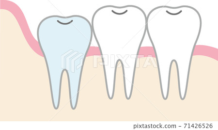Wisdom tooth illustration - Stock Illustration [71426526] - PIXTA