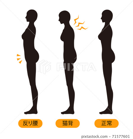 Female medical posture (warped waist, stoop)... - Stock Illustration ...