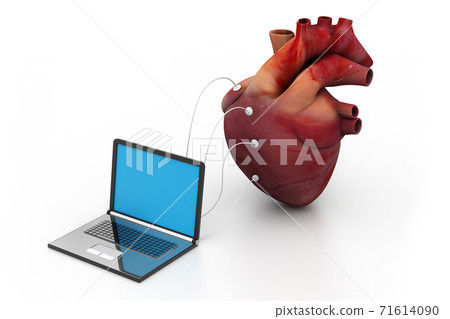 computer connected to a human heart. - Stock Illustration [71614090 ...