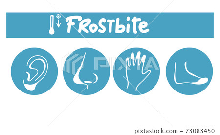 Frostbite icons set. Outline set of frostbite... - Stock Illustration ...