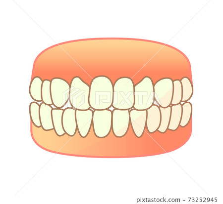 Full Denture Illustration: Dental Illustration - Stock Illustration ...