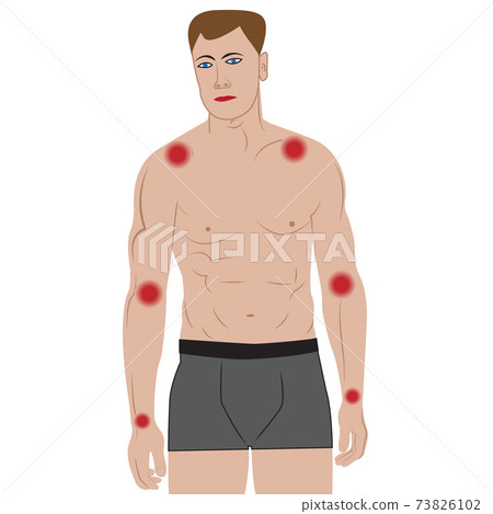 Joint pain in arms from infected or injury male... - Stock Illustration ...