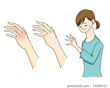 Rough hands, a painful woman - Stock Illustration [73890525] - PIXTA