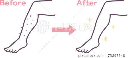 Before and after illustration material of... - Stock Illustration ...