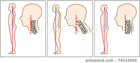Straight neck straight-neck - Stock Illustration [74018989] - PIXTA