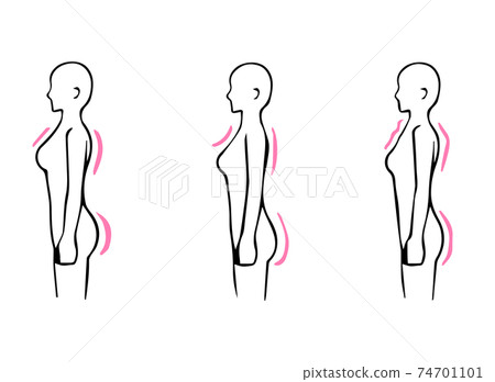 Skeleton diagnosis 3 types horizontal side body... - Stock Illustration ...