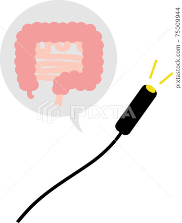 Large intestine camera examination - Stock Illustration [75009944] - PIXTA