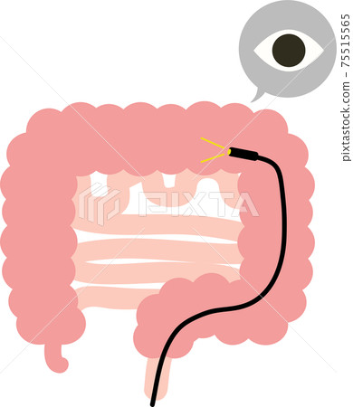 Scope type colon camera inspection - Stock Illustration [75515565] - PIXTA