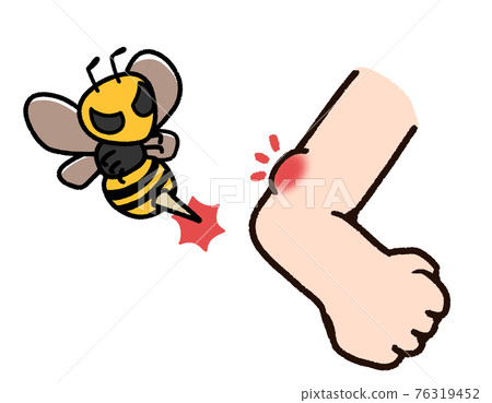Insect bite arm bee - Stock Illustration [76319452] - PIXTA