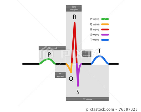 ecg waveform, Normal Atrial And Ventricular... - Stock Illustration ...