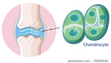 Informative poster of chondrocyte - Stock Illustration [76698482] - PIXTA
