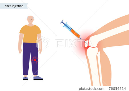 Knee Injection xray - Stock Illustration [76854314] - PIXTA