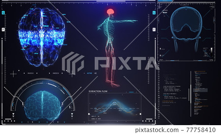 Brain scan screen animation. Screen with... - Stock Illustration ...