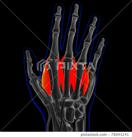 Dorsal Interossei Muscle Anatomy For Medical... - Stock Illustration ...