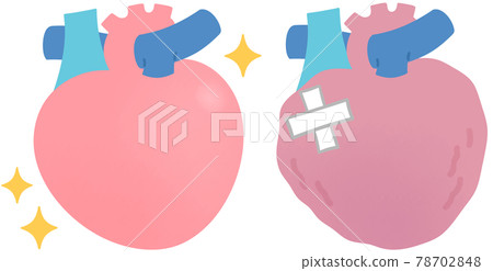 A healthy heart and a weak heart - Stock Illustration [78702848] - PIXTA