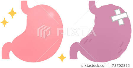 A healthy stomach and a weak stomach - Stock Illustration [78702853 ...