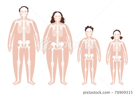 Obese skeleton anatomy - Stock Illustration [78909315] - PIXTA