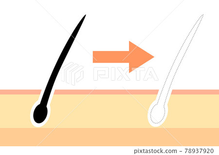 hair, hair root, vector - Stock Illustration [78937920] - PIXTA