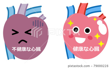 Illustration of healthy and unhealthy heart - Stock Illustration ...