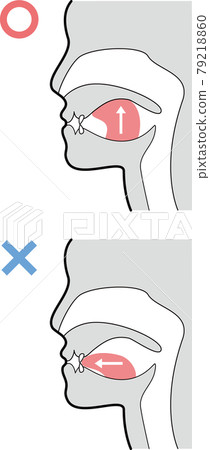 Correct tongue position - Stock Illustration [79218860] - PIXTA