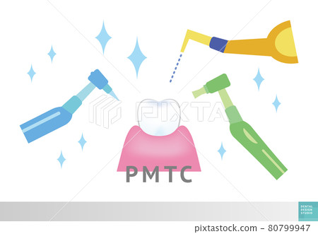 Illustration of dentist Dental PMTC cleaning... - Stock Illustration ...