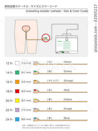[Medical] Indwelling bladder catheter size and... - Stock Illustration ...