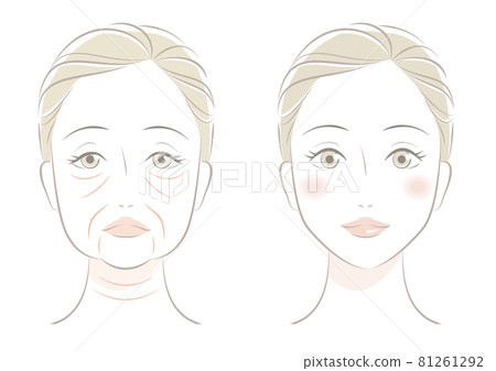 Slack in the face - Stock Illustration [81261292] - PIXTA