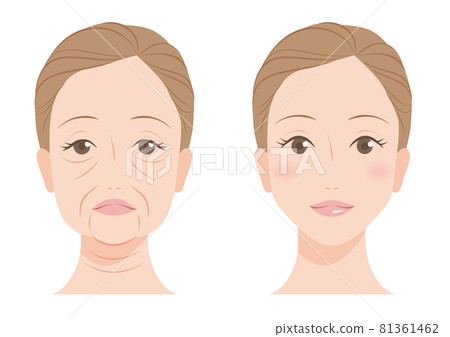 Slack in the face - Stock Illustration [81361462] - PIXTA
