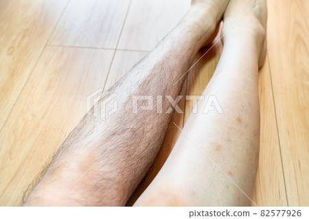 A photo of a man with shaved legs. Photos... - Stock Photo [82577926 ...
