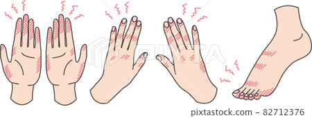 Illustration of rough hands and limbs - Stock Illustration [82712376 ...