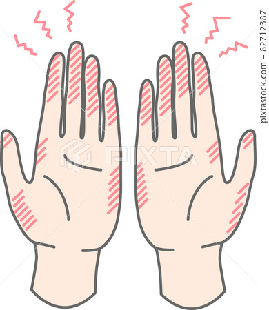 Illustration of rough hands - Stock Illustration [82712387] - PIXTA