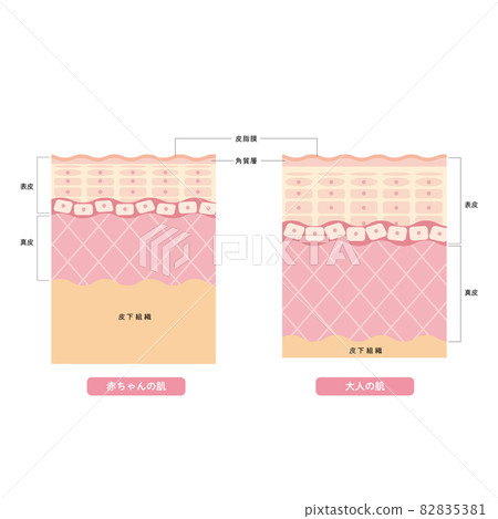 Differences between baby and adult skin Skin... - Stock Illustration ...