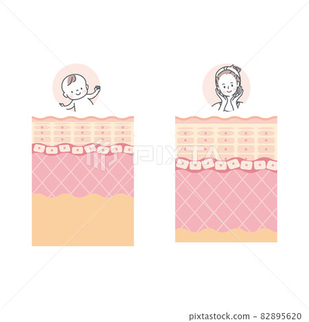 Differences between baby and adult skin Skin... - Stock Illustration ...