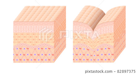 Skin cross section (wrinkles) - Stock Illustration [82897375] - PIXTA