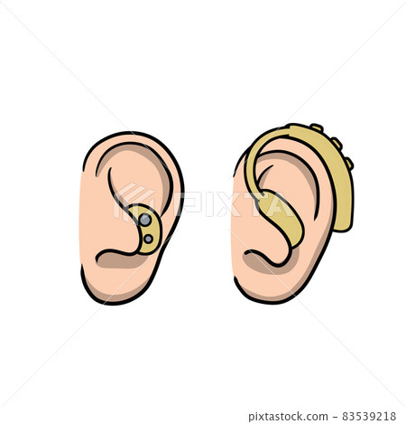 Hearing aid. Audiphone in ear. Hearing problems... - Stock Illustration ...