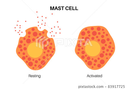 Mast cell poster - Stock Illustration [83917725] - PIXTA