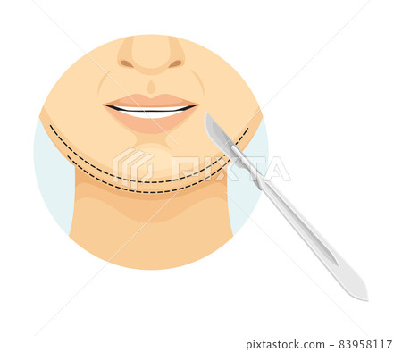 Chin correction procedure, cosmetic surgery on... - Stock Illustration ...
