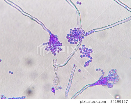 Penicillium Under Microscope 400x
