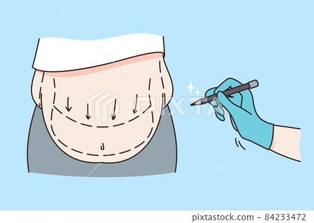Body care and liposuction concept. - Stock Illustration [84233472] - PIXTA