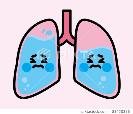 Lung character pulmonary edema - Stock Illustration [85450226] - PIXTA