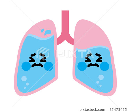 Lung character pulmonary edema - Stock Illustration [85473455] - PIXTA
