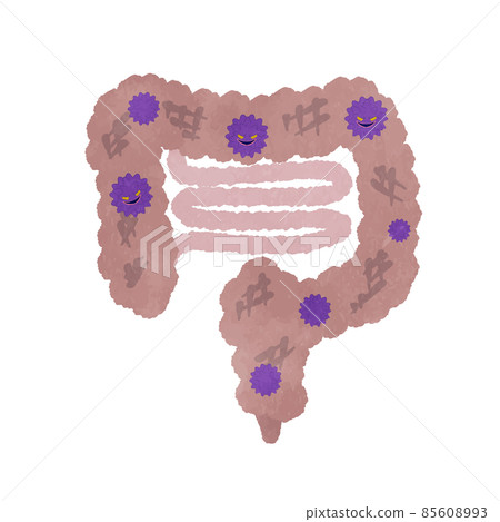 Illustration of an unhealthy intestine with bad... - Stock Illustration ...