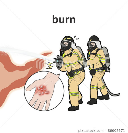 Burn disease medical illustration - Stock Illustration [86002671] - PIXTA