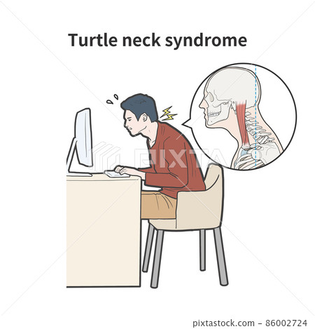 Turtle neck syndrome disease medical illustration - Stock Illustration ...