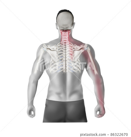 Medical illustration explaining a neck disc male - Stock Illustration ...