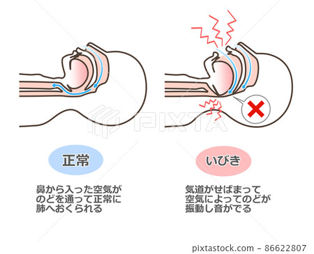 Illustrated illustration of snoring - Stock Illustration [86622807] - PIXTA